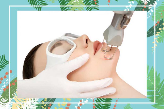 [Review] Sử dụng phương pháp Laser Fractional CO2 có tốt không?