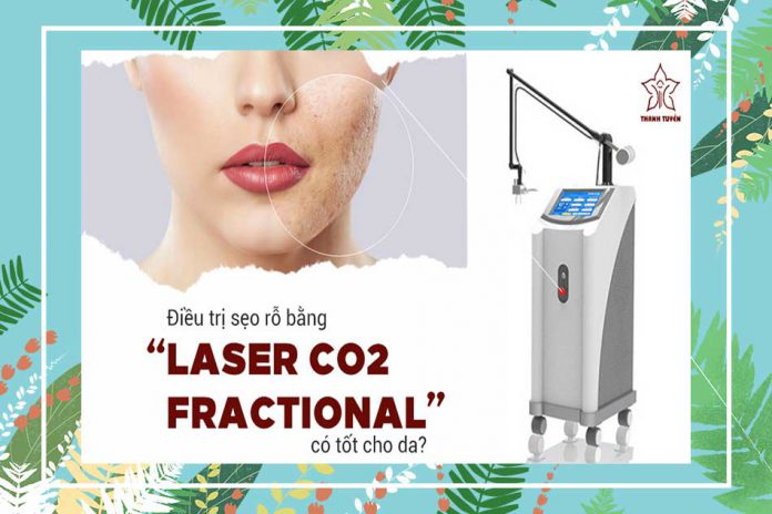[Review] Sử dụng phương pháp Laser Fractional CO2 có tốt không?